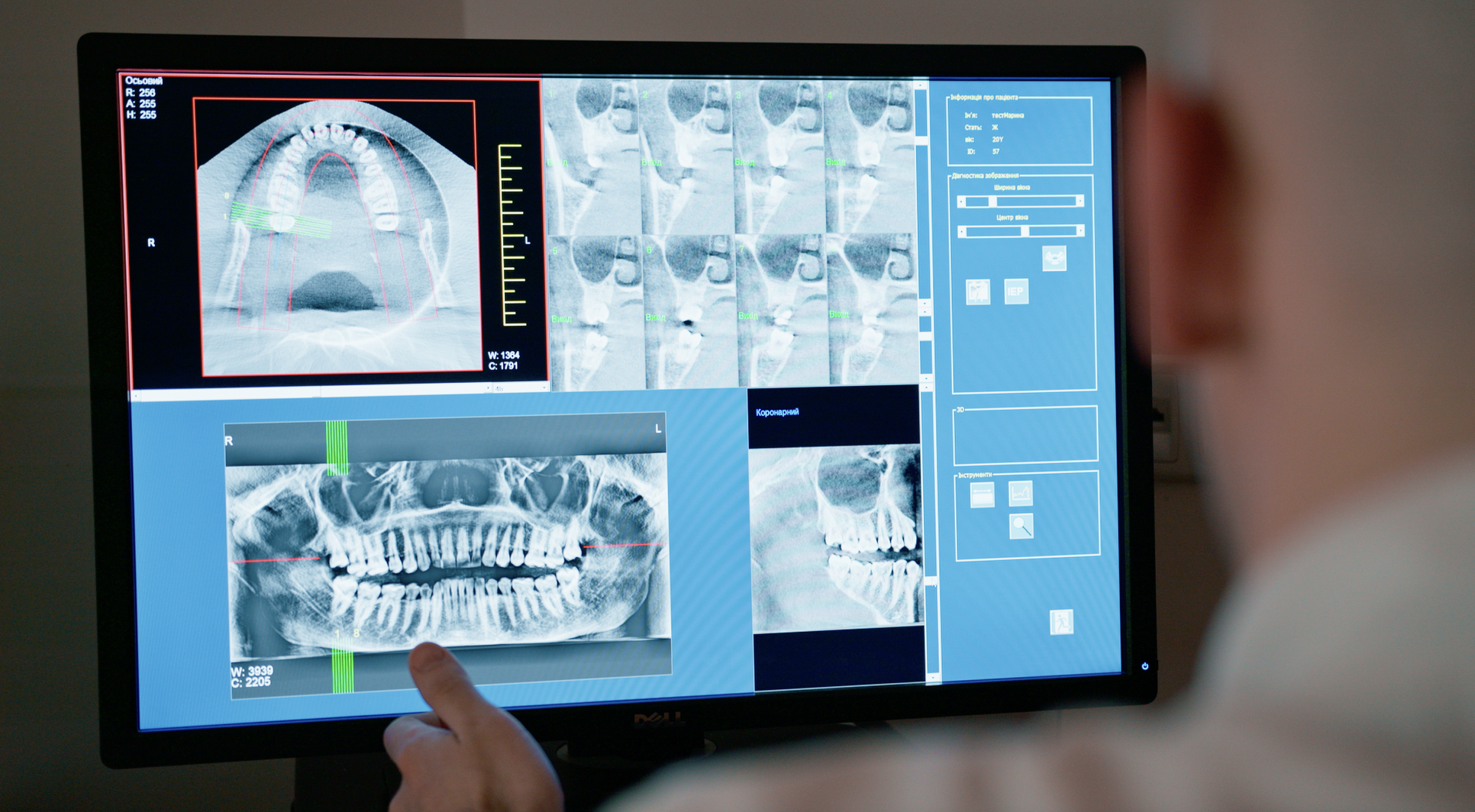 Ensemble Methods in ML: A Comprehensive Guide | Ultralytics